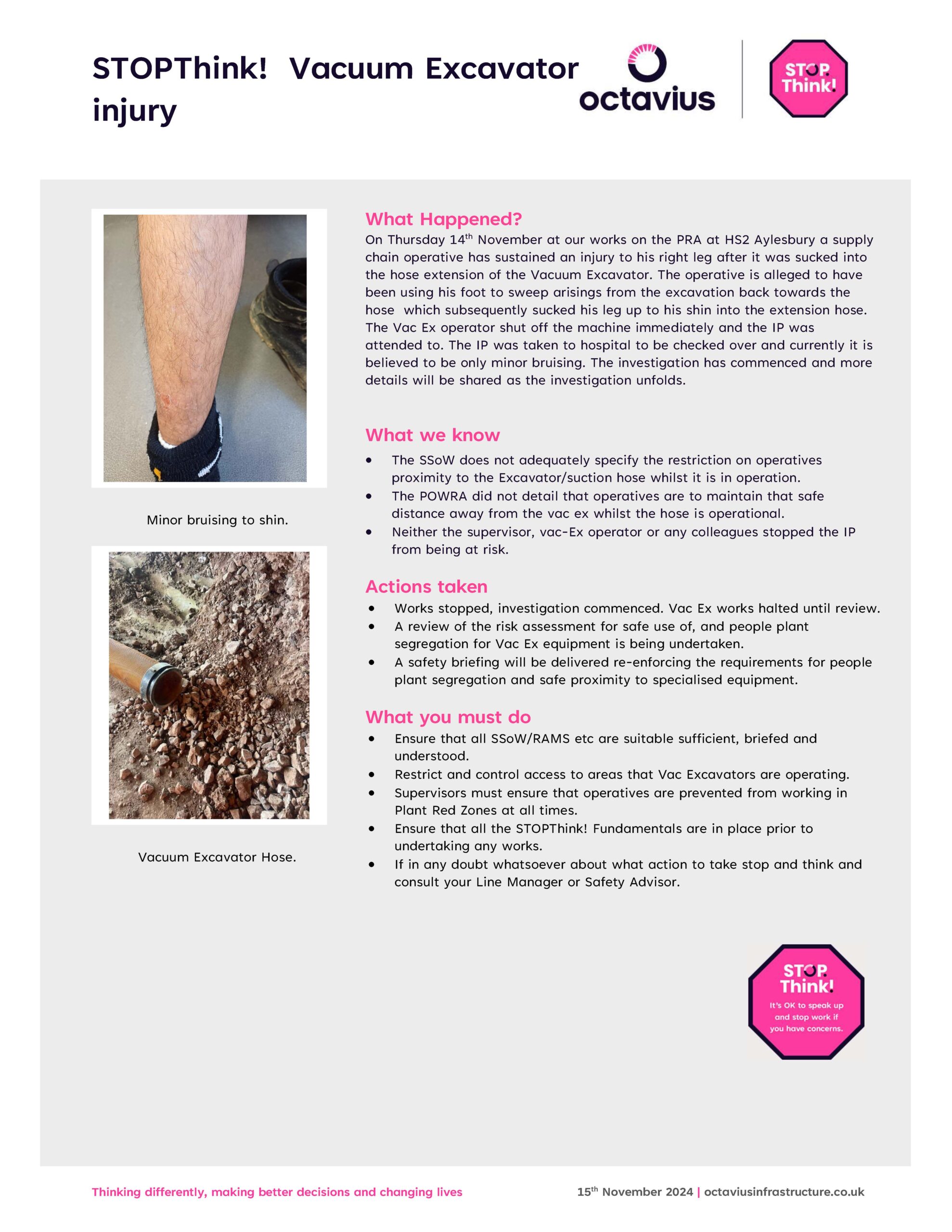 Vacuum Excavator Injury - StopThink!